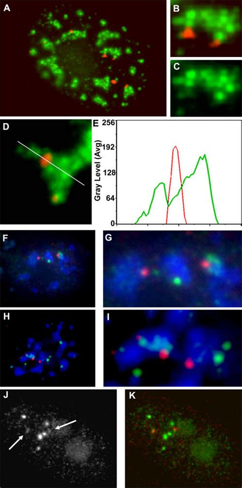 Distribution Of Dmpk Mrna And Sc 35 In Dm1 A Myotube Nuclei From A Download Scientific