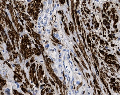 Tissue Tek Genie Rapid True Random Access Ihc Staining
