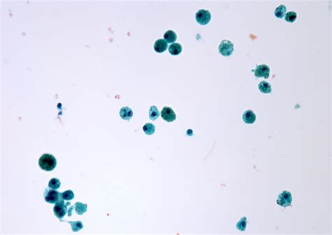 Pathology Outlines Nondiagnostic