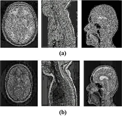 Comparison Of The Encryption And Decryption For Three Medical Images Download Scientific