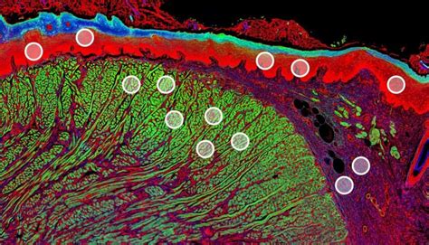 Patholytix Pathology News