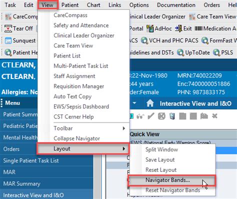 Customize Interactive View And Iando Iview Navigator Bands