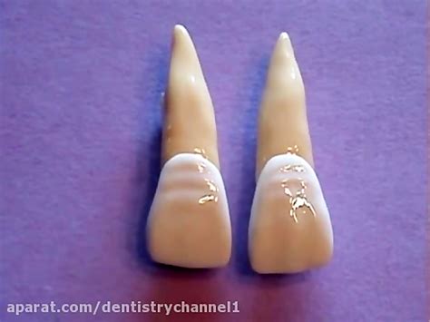 آناتومی دندان سانترال بالا