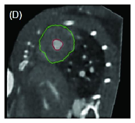 Examples Of 4d Murine Cardiac Micro Ct Images Using Retrospective Download Scientific Diagram