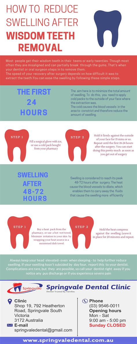 How To Reduce Swelling After Wisdom Teeth Are Removed Resortguess