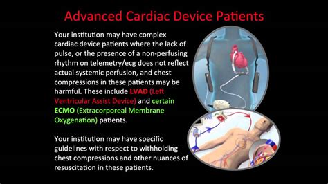 Criteria For Lvad Placement At Phoebe Reddall Blog