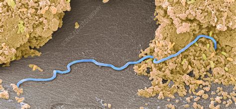 Faecal Bacteria Sem Stock Image C0584913 Science Photo Library