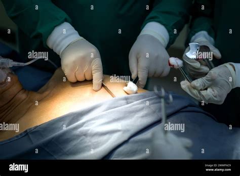 Hands Of Healthcare Professional Wearing Medical Glove Holding Scalpel And Surgical Knife