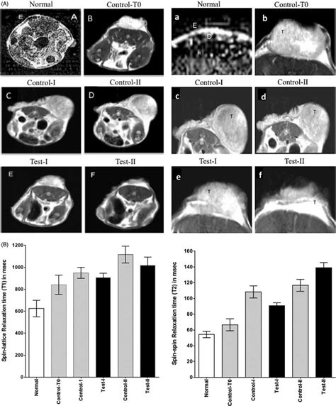 Magnetic Resonance Imaging And Relaxometry Parameter Of Doxorubicin Download Scientific Diagram