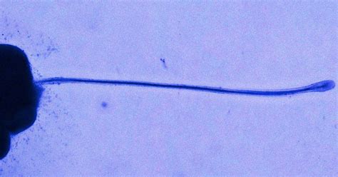 Scientists Grow Hair Follicles In Laboratory For The Very First Time