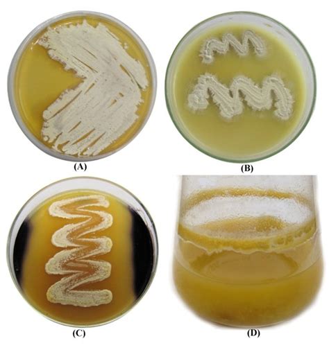 The Colored Photograph Of Streptomyces Sp Neae 94 Aerial Mycelium