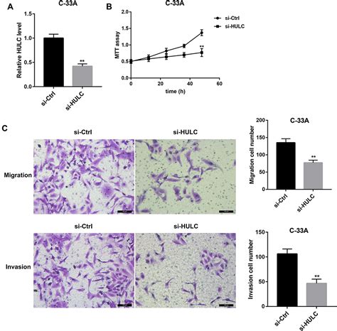 Long Non Coding Rna Hulc Promotes Cervical Cancer Cell Proliferation Ott