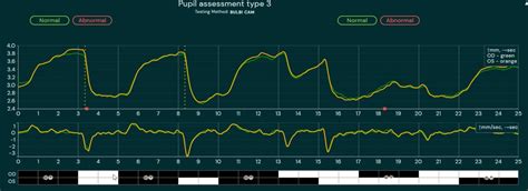 Current Tests Bulbitech