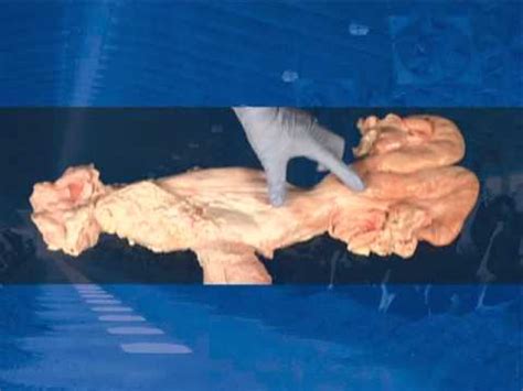 Reproductive Anatomy Of The Cow YouTube