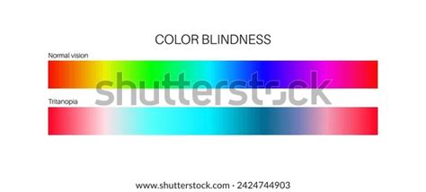 Tritanopia Vision Color Blindness Infographic Human Stock Vector