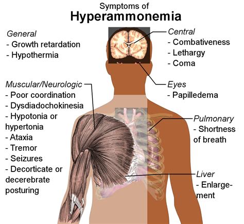 ملف Symptoms Of Hyperammonemia Svg المعرفة