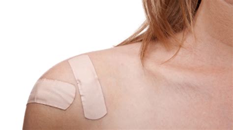 Shoulder Dislocation Management Health Choices First