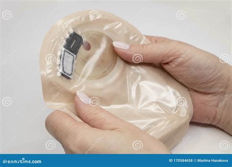 Top View On Colostomy Bag Needed After Colostomy Surgery Colon Cancer Treatment Ostomy Bag