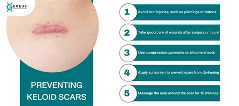 Causes And Prevention Of Keloid Scars