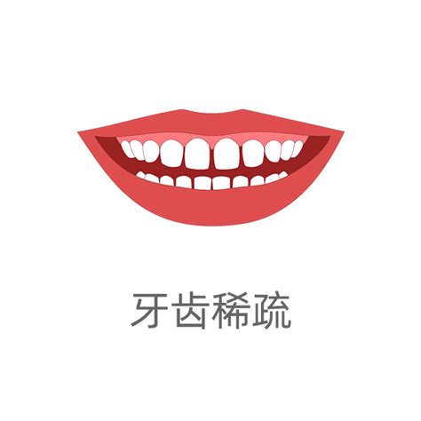 牙列稀疏