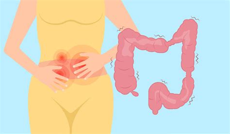 Constipation What Is Symptoms Causes Treatment And Prevention