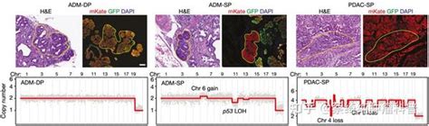 P53蛋白缺失诱导癌症基因组进化 知乎
