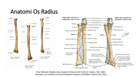 Power Point Fraktur Distal Radius Rehand Pptx