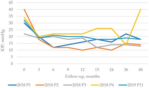 Micropulse Diode Laser Cyclophotocoagulation At Warren Short Blog Micropulse Diode Laser Cyclophotocoagulation At Warren Short Blog