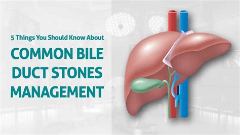 Ais Medical Network · 5 Things You Should Know About Common Bile Duct