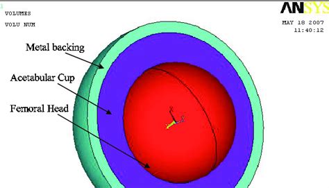 Finite Element Model Of Acetabular Cup With Femoral Head And Metal Backing Download