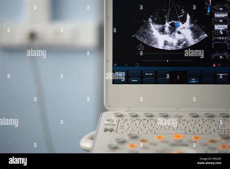 Echocardiogram Procedure Hi Res Stock Photography And Images Alamy