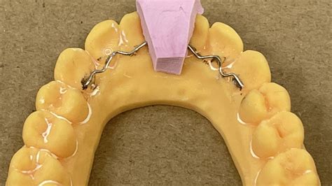 Orthodontic Retainers Albury Wodonga Orthodontics