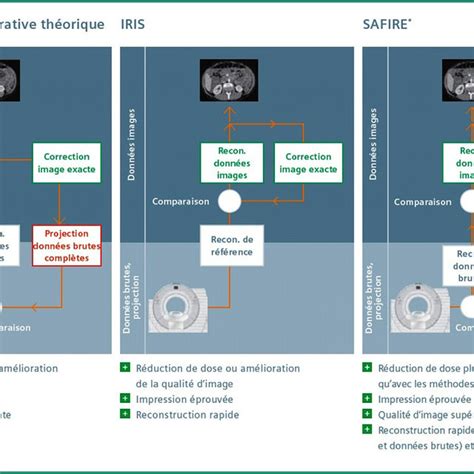 Méthode De Reconstruction Itérative Sinogram Affirmed Iterative Download Scientific Diagram