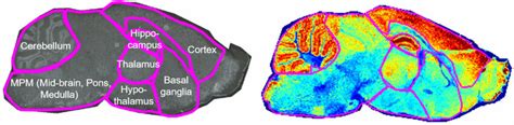 Mouse Brain Compartmentalization Used In This Study The Sagittal Plane Download Scientific