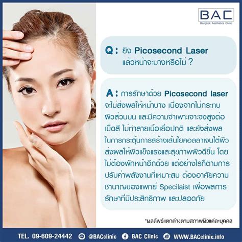 Pico Laser ที่ไหนดี รักษาฝ้า กระ รอยสิว หลุมสิว รีวิวคนไข้จริงเท่านั้น Bac Clinic