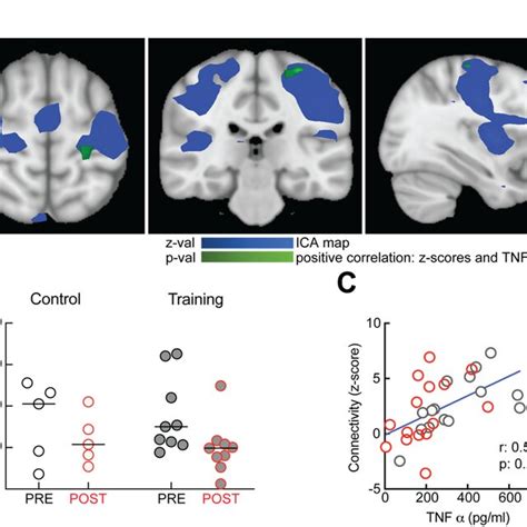 Correlation Between Tnfα And Connectivity In The Sensorimotor Network Download Scientific