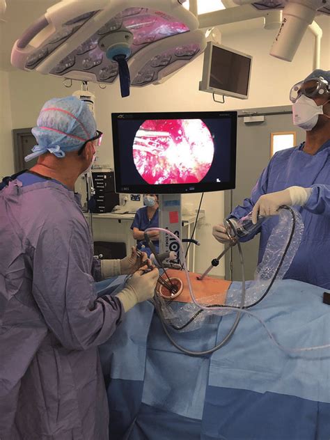 Operating Room Setting In A Typical Case Of Lower Lobe Segmentectomy Download Scientific Diagram