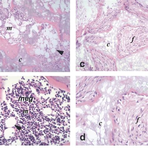 Histology Of Ectopic Ossicles Formed By Normal And Mas Stromal Cells