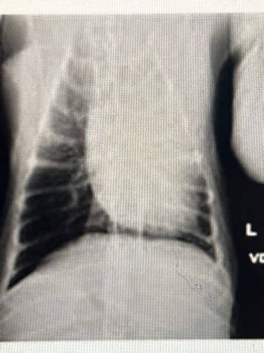 Radiology Lec PART Flashcards Quizlet