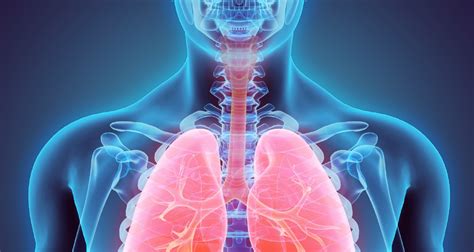 Eduard J On Linkedin A Case Of Worsening Dyspnea A Chronic