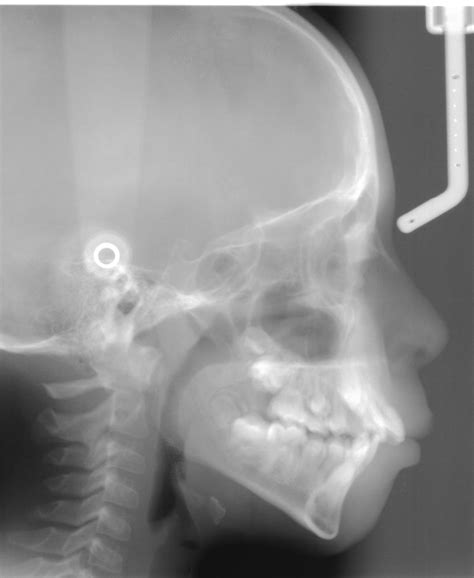 Imagenes Cefalometria Object Detection Dataset And Pre Trained Model By