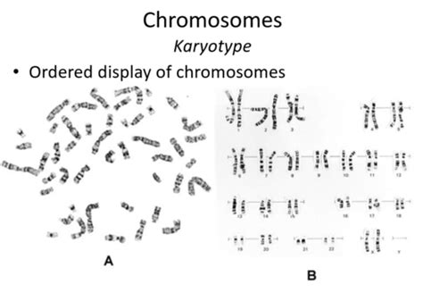 Genetic Disease Flashcards Quizlet