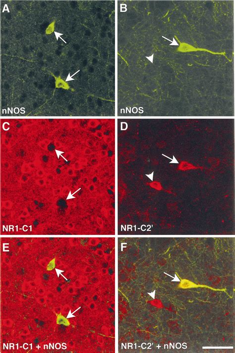 Localization Of NNOS And The C And C Segments Of NMDAR In The Download Scientific Diagram