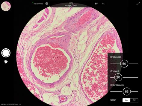 Echo Pro By Echo Laboratories