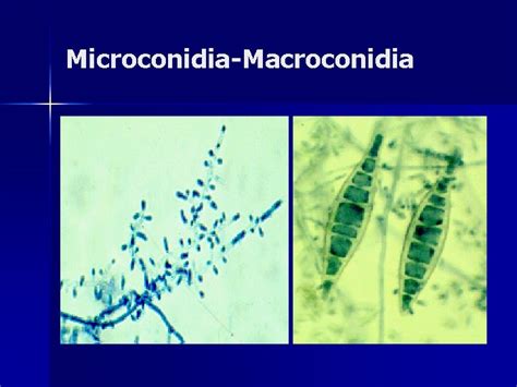 Introduction Medical Mycology Prof Dr Asem Shehabi Faculty Introduction Medical Mycology Prof Dr Asem Shehabi Faculty