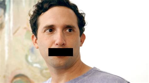 Omg A Straight Guy Gets His Lips Done Omgblog