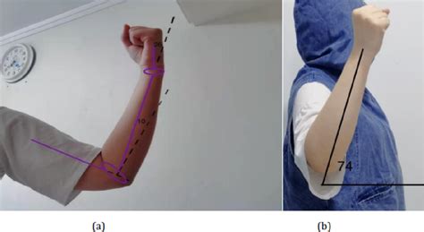 Figure 1 From Design And Simulation Of An Upper Limb Rehabilitation Exoskeleton Robot Semantic