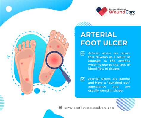 Diabetic Foot Ulcer And Foot Sores Treatment In Lubbock Tx