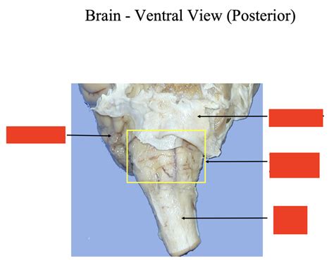 Ventral View Posterior Diagram Quizlet