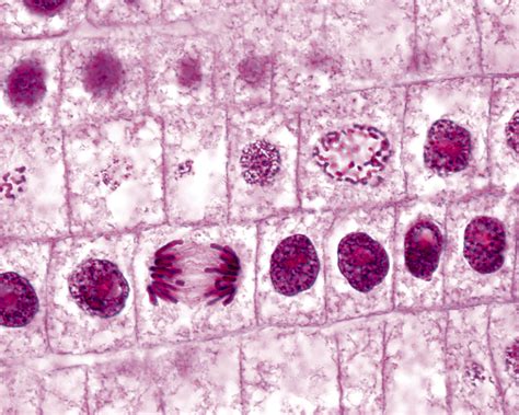 Stages Of Mitosis Under Microscope